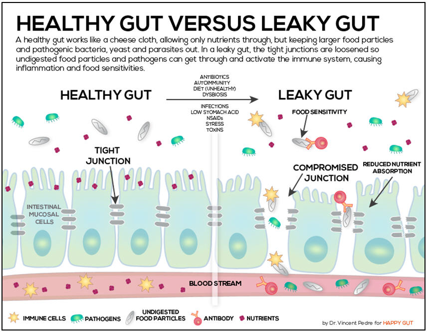 Leaky Gut Inflammation Autoimmune Diseases Food And Your Addictive Mind Leaky Gut Inflammation Autoimmune Diseases Food And Your Addictive Mind